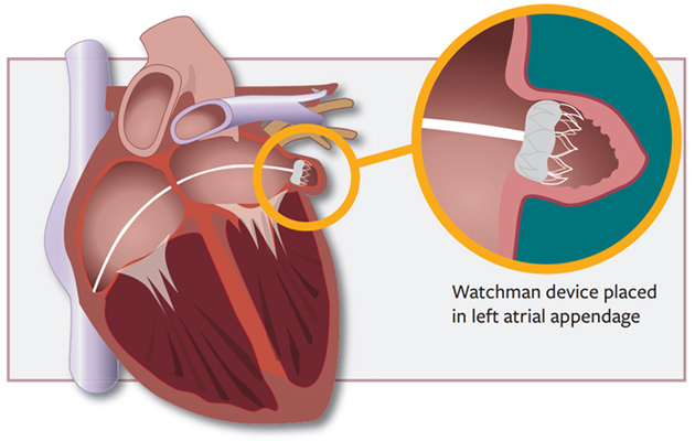 Procedures that may be done - Northern Light Health